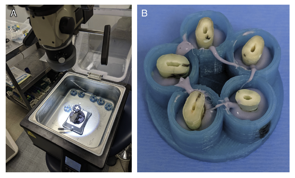 Micro–computed Tomographic Evaluation of the Shaping Ability of WaveOne ...